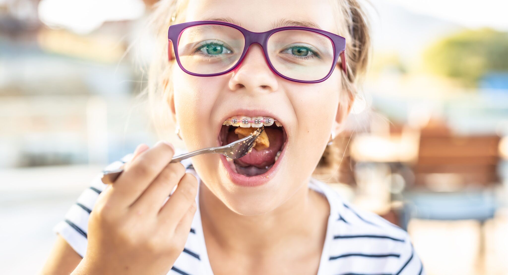 Eating Out With Braces in Woodbridge: Tips and Tricks for Local Teens ...